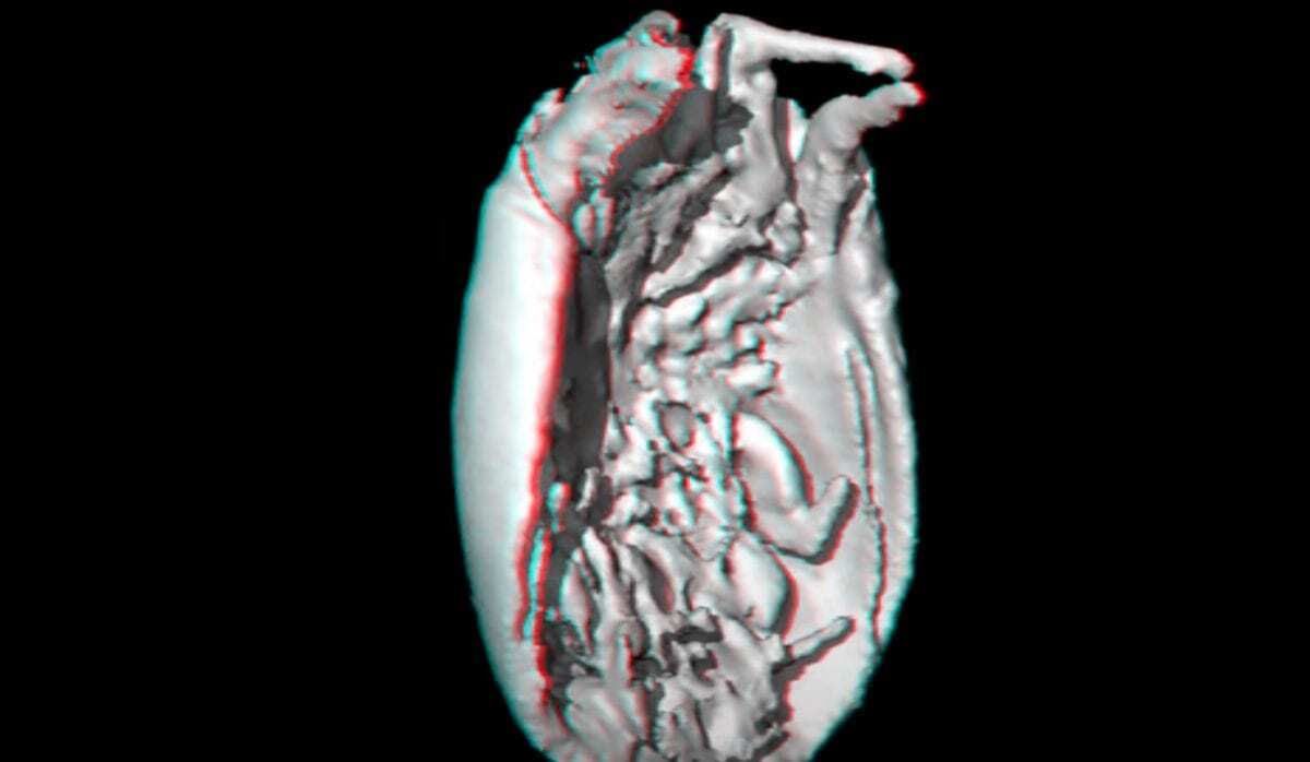 Scans Catch Prehistoric Mite Hitching Ride On 50 Million Year Old Spider