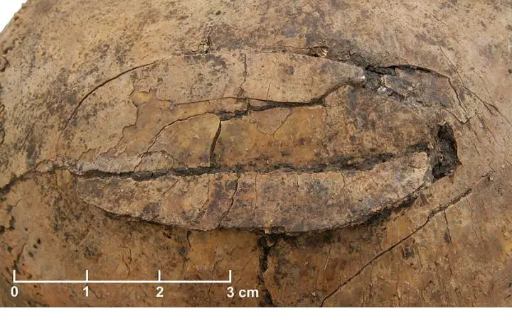 Massacres, torture and mutilation: Extreme violence in neolithic ...