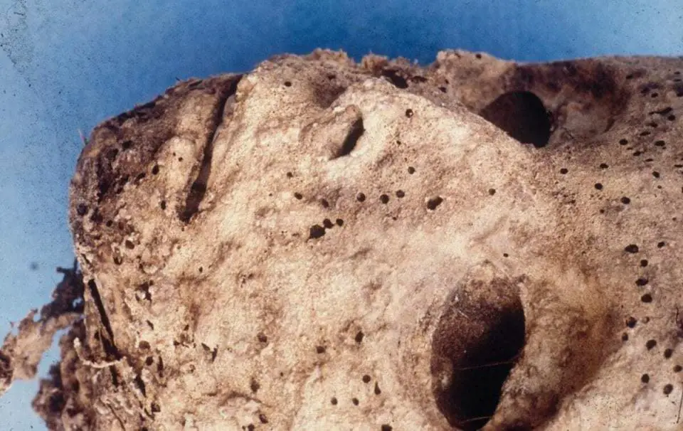 DNA analysis of ancient mummy, thought to have smallpox, points to ...