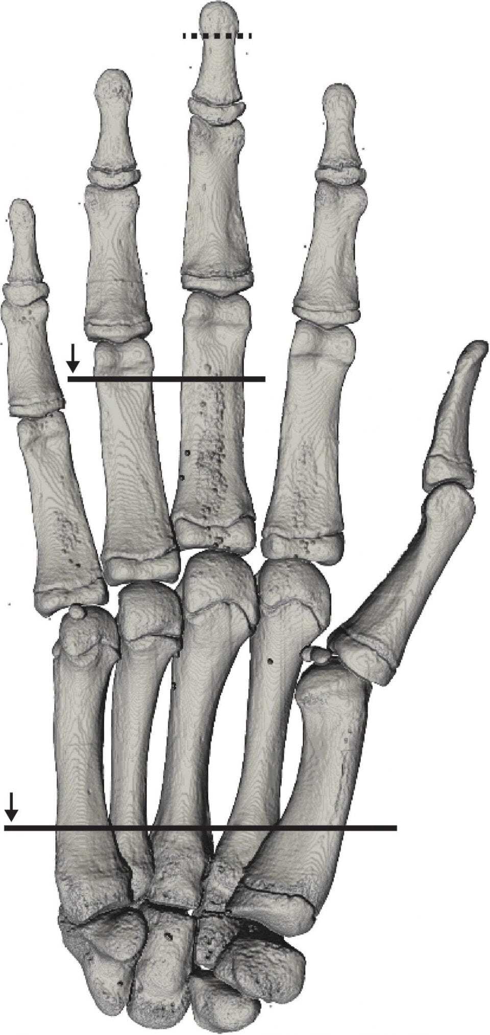 Ancient details of mummy’s hand revealed with advanced radiology technique