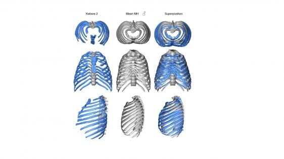 Study reconstructs Neandertal ribcage, offers new clues to ancient ...
