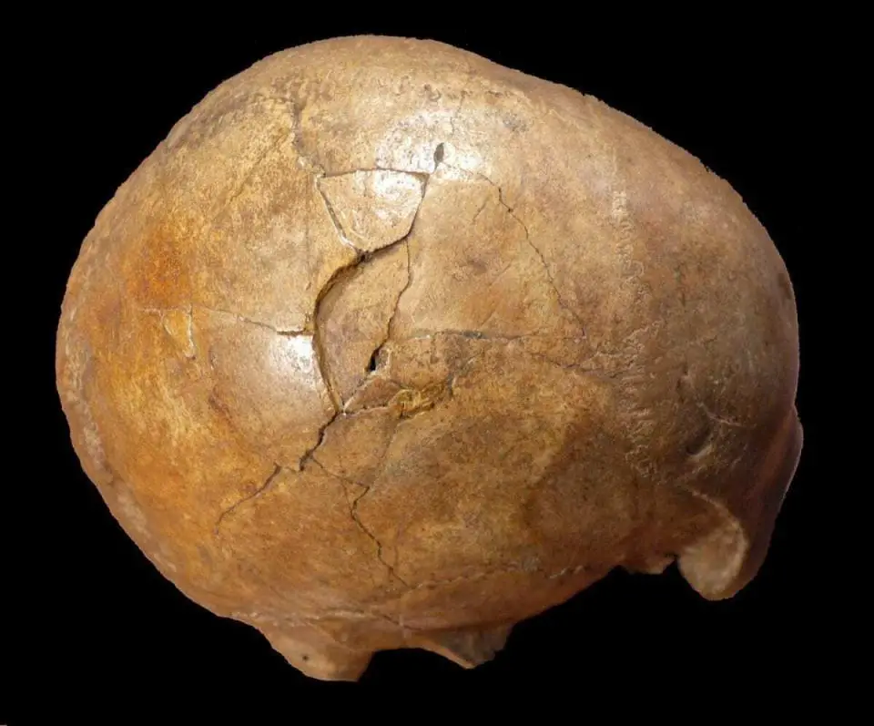Murder in the Paleolithic? Evidence of violence behind human skull remains
