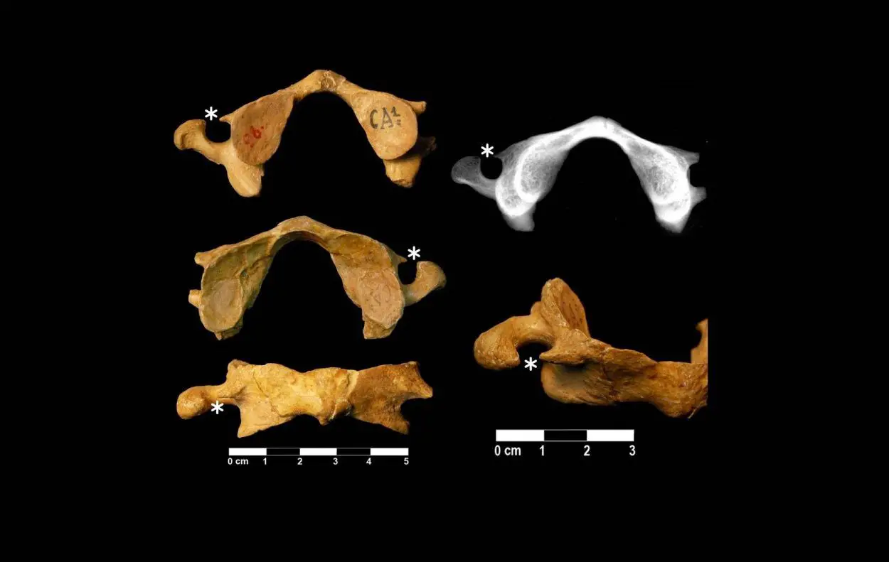 New data supports the theory of Neanderthal’s low genetic diversity as ...