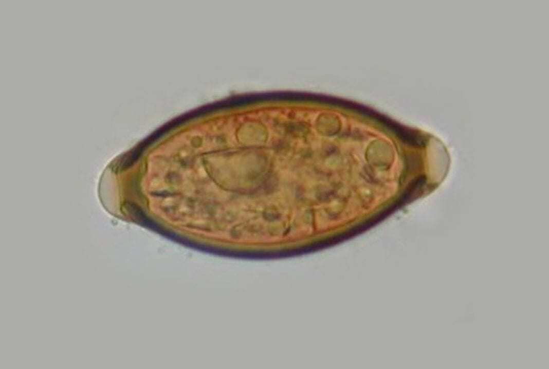 Helminth Infections Common in Medieval Europe, Grave Study Finds