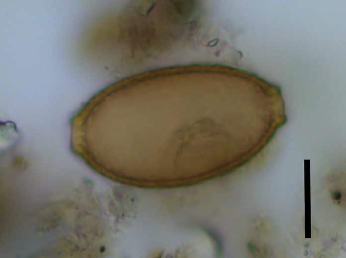 Faeces found near Stonehenge contains prehistoric parasites