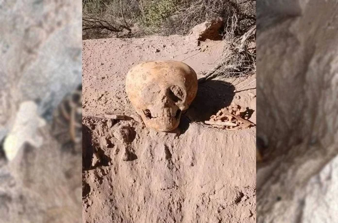 Experts explain the cultural origin of the mysterious deformed skull